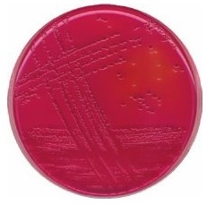 Medios cromogénicos: Bacteriología en color - Bioartis SRL